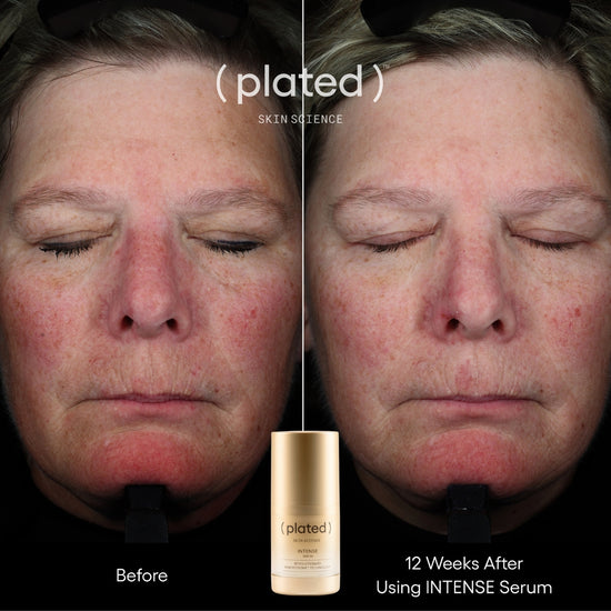 Plated Skin Science INTENSE Serum | Skin Truth