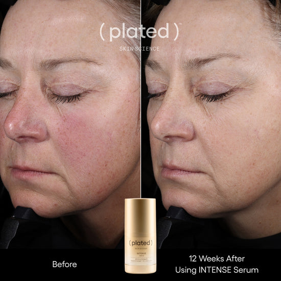 Plated Skin Science INTENSE Serum | Skin Truth