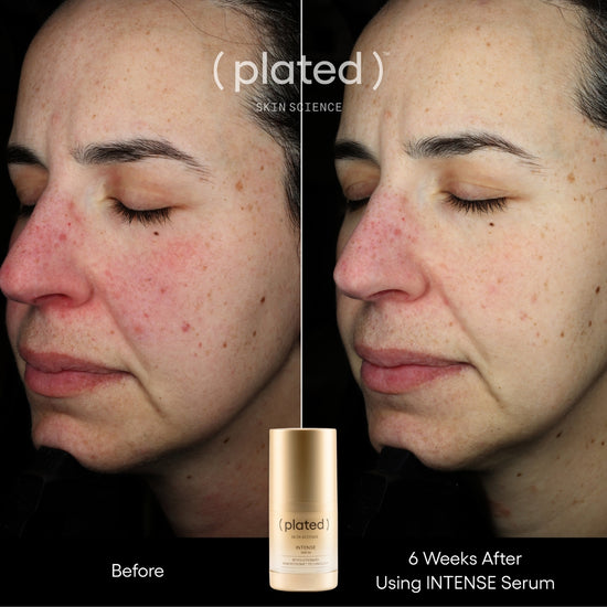 Plated Skin Science INTENSE Serum | Skin Truth